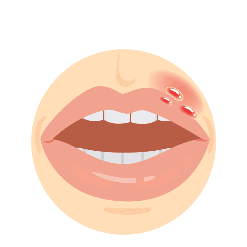 Oral Health in The Winter: 8 Dental Problems You Can Avoid